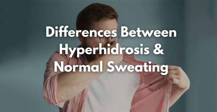 Differences Between Hyperhidrosis And Normal Sweating