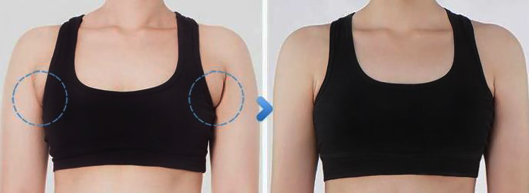 5 Most Effective Exercises To Get Rid Of Armpit Fat